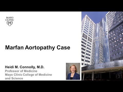 Marfan Aortopathy Case