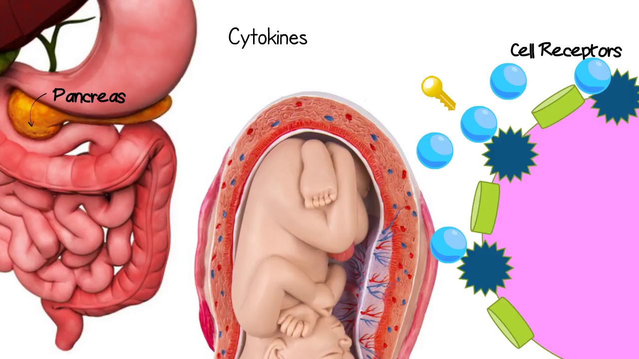 What is Gestational Diabetes (Animation)