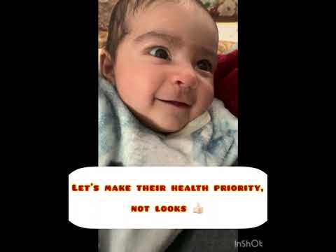Is it safe to apply kajal in Infants' Eyes?