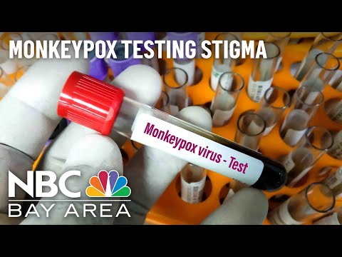 Monkeypox Stigma Leads to Low Demand for Testing, Experts Say