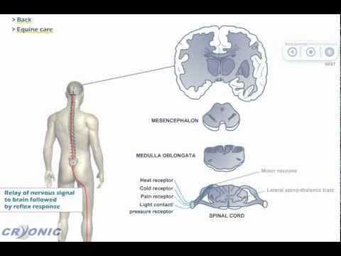 Cryonic Medical - NeuroCryoStimulation Explained