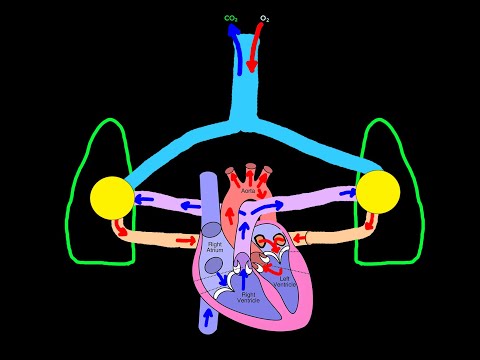 Patent Foramen Ovale and its Consequences: Do You Have a Hole in Your Heart? 20% of You Might!