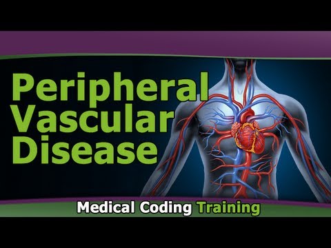 Peripheral Vascular Disease - ICD-9 Coding for Beginners