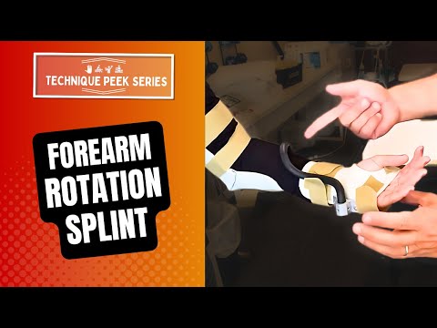 How to Create a Static Progressive Forearm Rotation Splint  |  Technique Peek Series