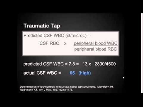 CSF Analysis – EM in 5