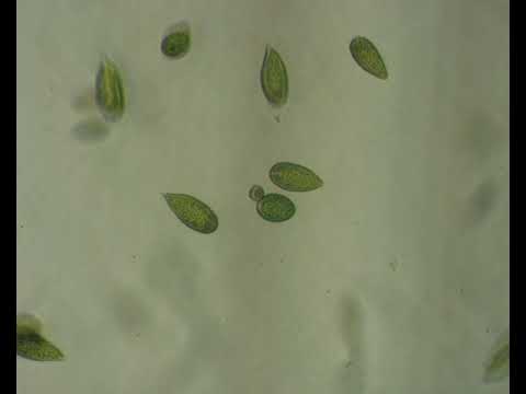 Gonyostomum | Wikipedia audio article