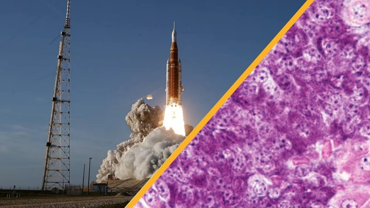 Major Science Breakthroughs: Moon Mission, Diabetes Cure, and Climate Impacts