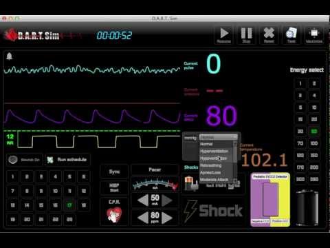ECG Simulator - Electrocardiogram Simulator Latest Price, Manufacturers ...