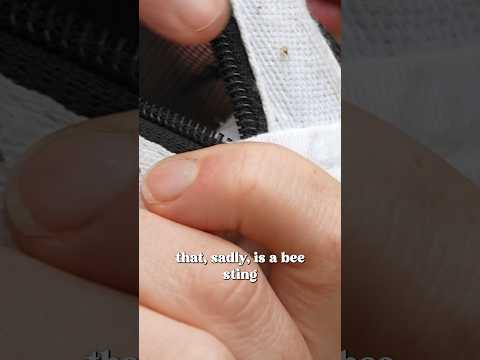 What happens when a bee stings you? | Maddie Moate #shorts | #bees #beefacts