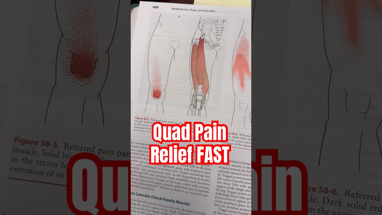 How to Fix Quad Pain FAST