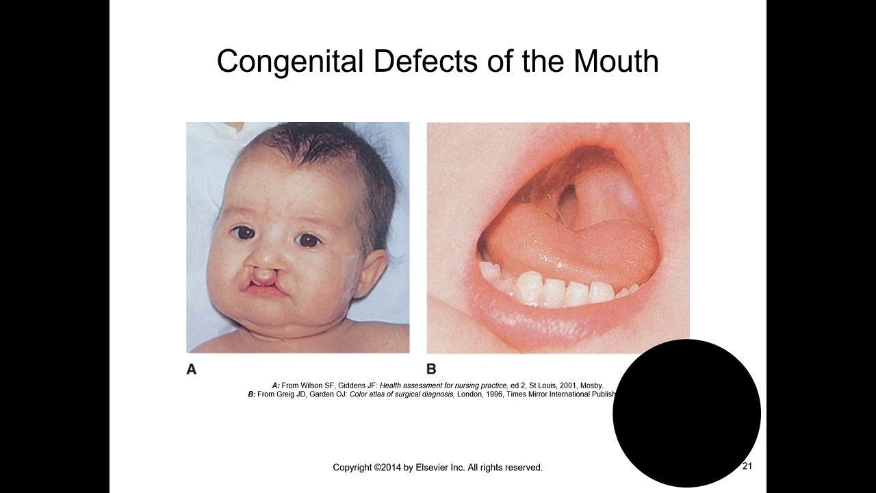 HCE190 Chapter 18 Lecture