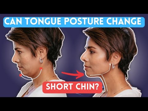MEWING: Change TONGUE POSTURE for Defined Jawline /Face yoga for Face Shape (Episode-1)