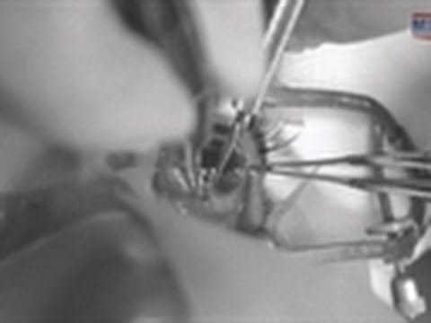 Army Elite - Eye Doctor on a Mission