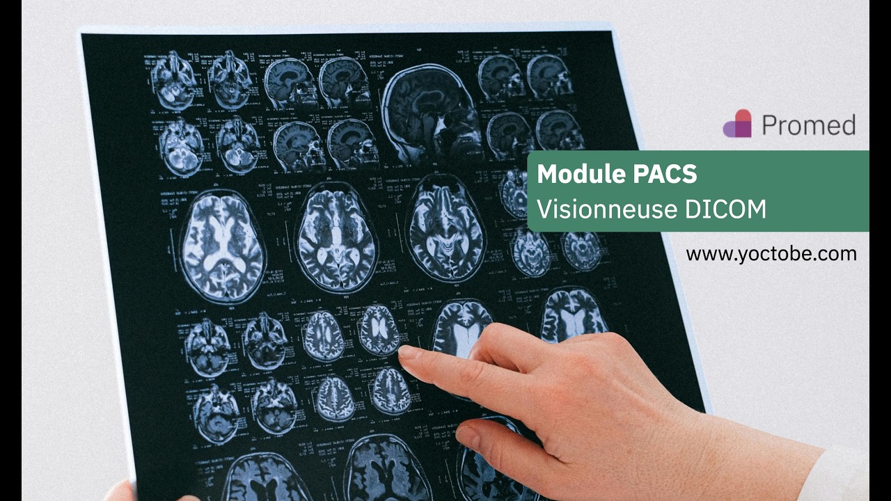 Module PACS Promed HIS Par Yoctobe