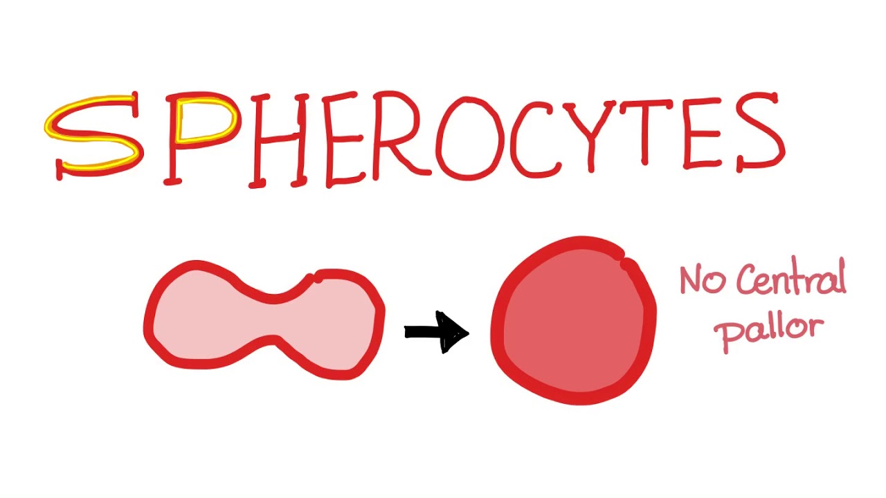 Spherocytes