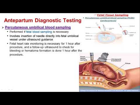 Prenatal screening Fetal Testing and Maternal Newborn Nursing - Ultrasound, BPP, NST and CST NCLEX