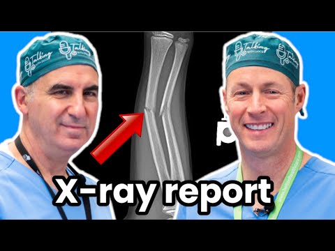 Knee X-rays 101. How To Interpret Your X-ray Report