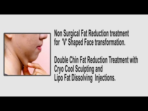 Double Chin Reduction with Cryo Cool Sculpting & Lipo Fat Dissolve Injections. Contact: 9700020802