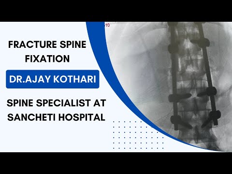 Spine Surgeon Pune | Best Spine Doctor | Dr. Ajay Kothari