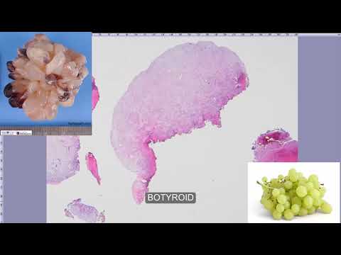 HacettepePathology.COM Case #3
