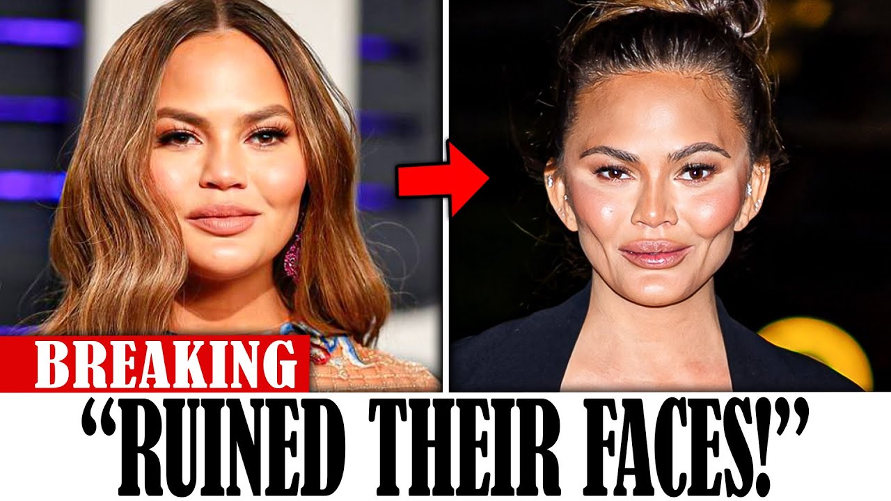 8 Hollywood Stars Who RUINED Their Face With Buccal Fat Removal