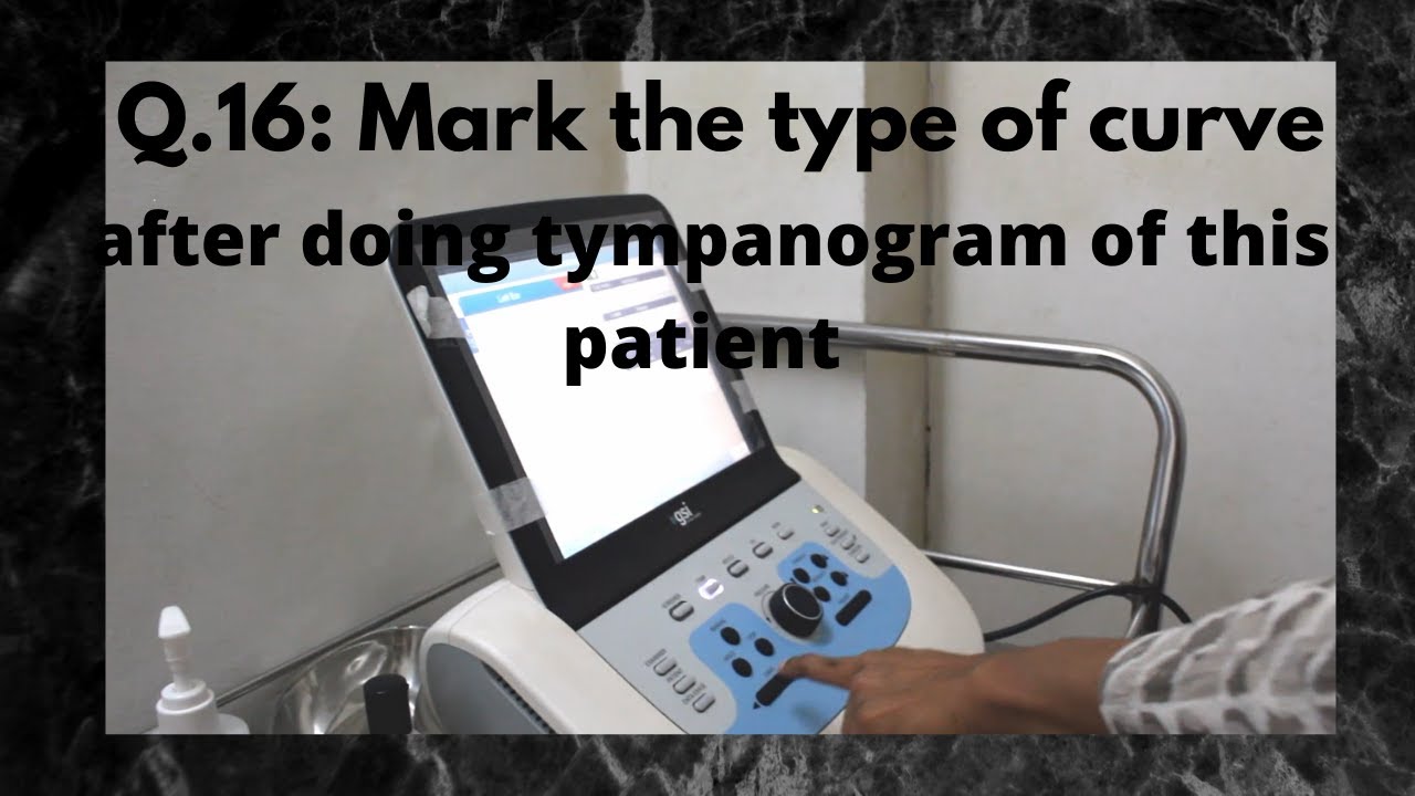 043. Impedance Audiometry; Tympanogram & Acoustic Reflex  #audiology  #osce