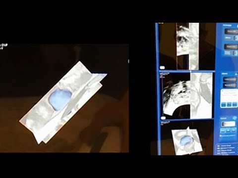 Institut Mutualiste Montsouris: Innovation and evaluation - personailsed treatment