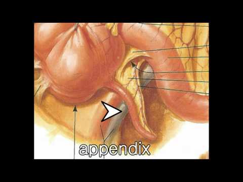 Appendicitis: An Overview