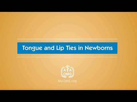 Tongue and Lip Ties in Newborns