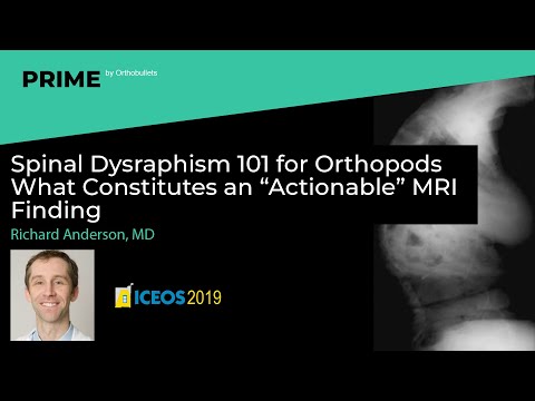 Spinal Dysraphism 101: What constitutes an “actionable” MRI finding - Richard Anderson, MD