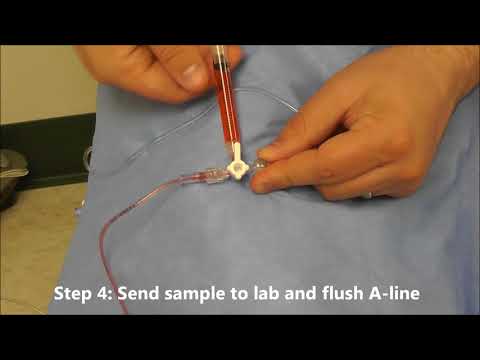 How to Draw Labs from an Arterial Line