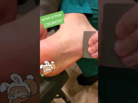 Treating ADHESION in the PLANTAR FASCIA for PLANTAR FASCIITIS