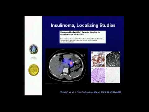 Functioning Islet Cell Tumors: Juan-Pablo Pantoja, M.D.