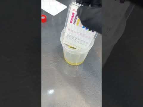 Urine drug test tutorial