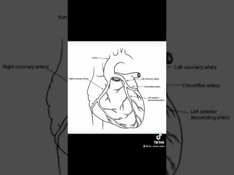 Brief Coronary Artery Disease Example (#health #medicine #heart)