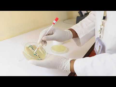 URINE CULTURE AND SENSITIVITY TEST