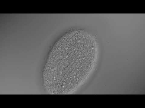 A spathidid full of Bacteria.