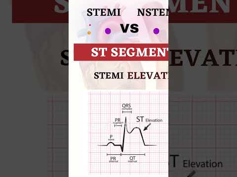 STEMI vs NSTEMI #medico #shortsvideo #shorts #nursing #stemi #nstemi