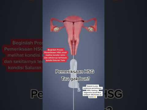 Seperti Inilah Pemeriksaan HSG (Histerosalpingografi)