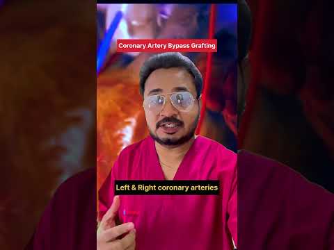 What is a coronary artery bypass grafting ? Most asked question by patients #doctor