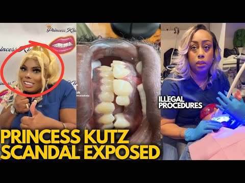VENEER TECH FACING PRISON TIME?