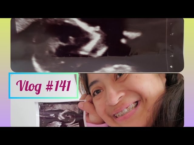 Youtuber EvyReds revela que está embarazada