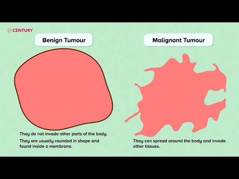 Benign & Malignant Tumours | Biology
