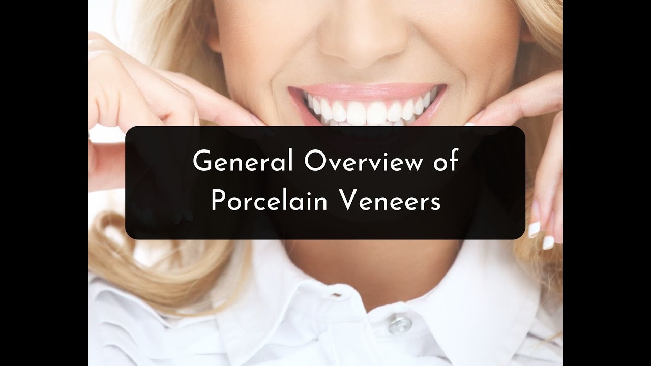 What Are Porcelain Veneers? Overview of Porcelain Veneers