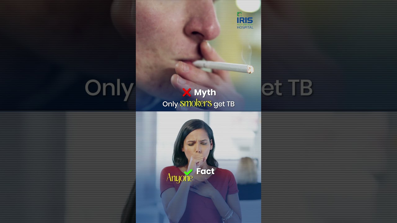 Tuberculosis Myths Busted | Can Anyone Get TB?