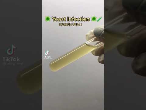Yeast infection as seen under the microscope. #shorts #Shorts