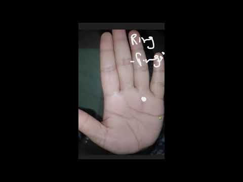#Palmistry - How to work Black Mole in Hand (English) #short #video #black #mole #inhand