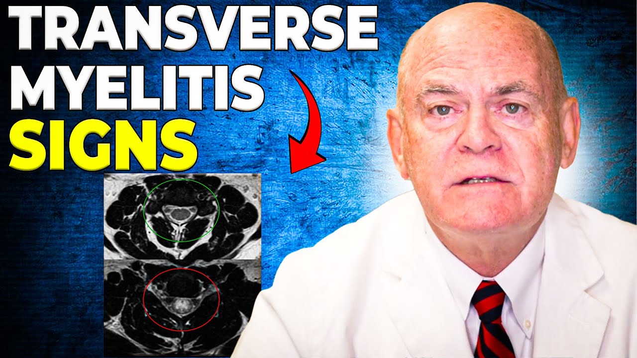 Warning: Understanding Transverse Myelitis Symptoms