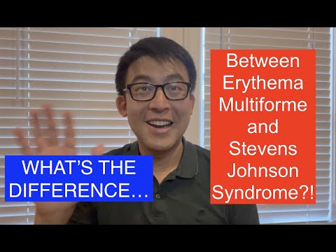 How to tell EM and SJS apart! (target vs. targetoid lesions)