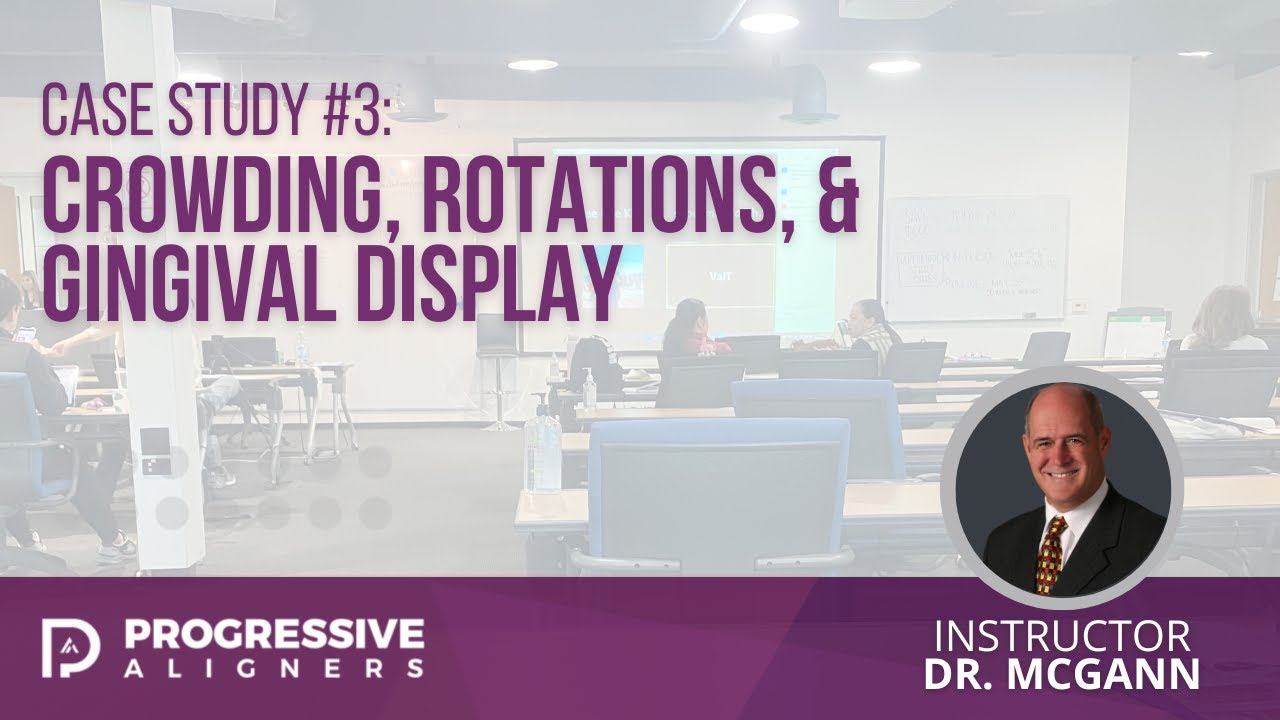 Case Study #3: Crowding, Rotations, & Gingival Display | Dr. McGann